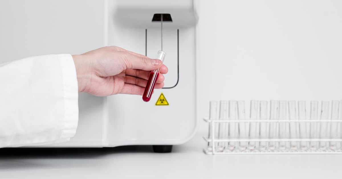 Whole Blood Analysis - An invaluable tool in preclinical testing - Immuneed